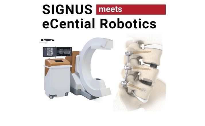 SIGNUS passion: setting new standards in spinal surgery