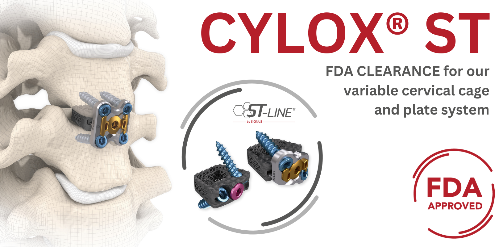SIGNUS Receives FDA Approval for CYLOX® ST cage and plate system