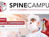 SIGNUS passion: setting new standards in spinal surgery