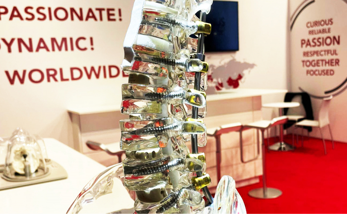 SIGNUS passion: setting new standards in spinal surgery