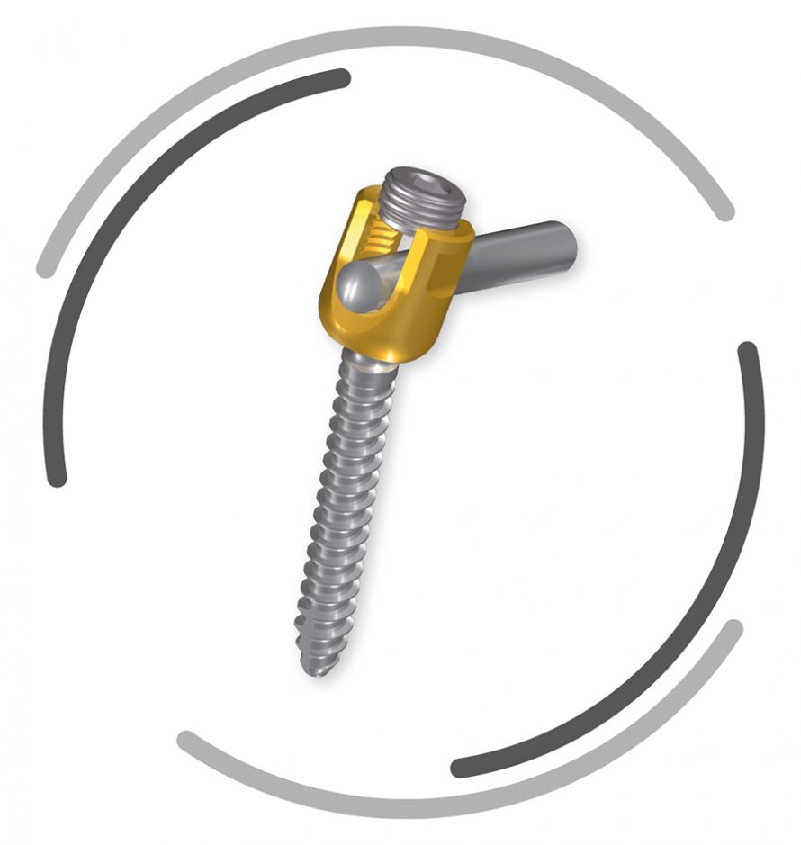 posterior, screw-rod-system, tulip, self-tapping