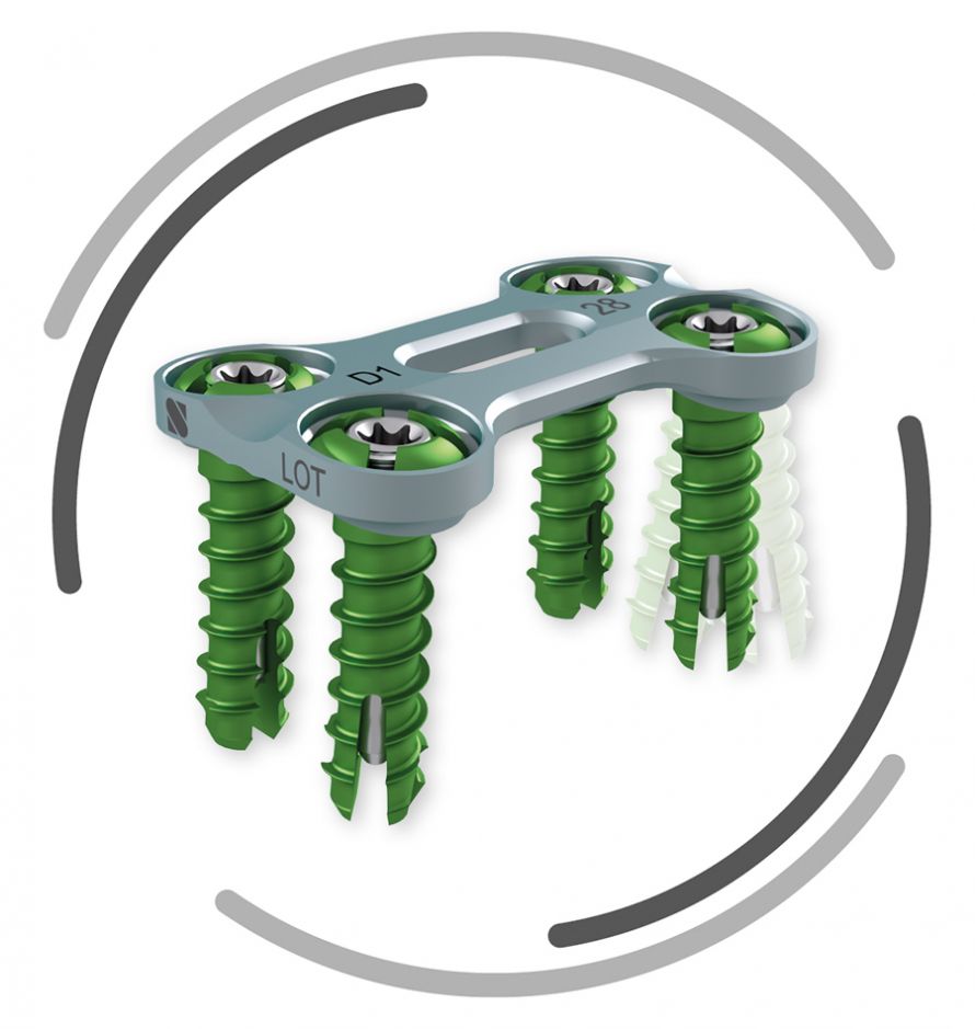 anterior, cervical, plate, screw, expansion, variable screws