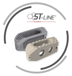 Das SIGNUS Portfolio für die operative Wirbelsäulenversorgung