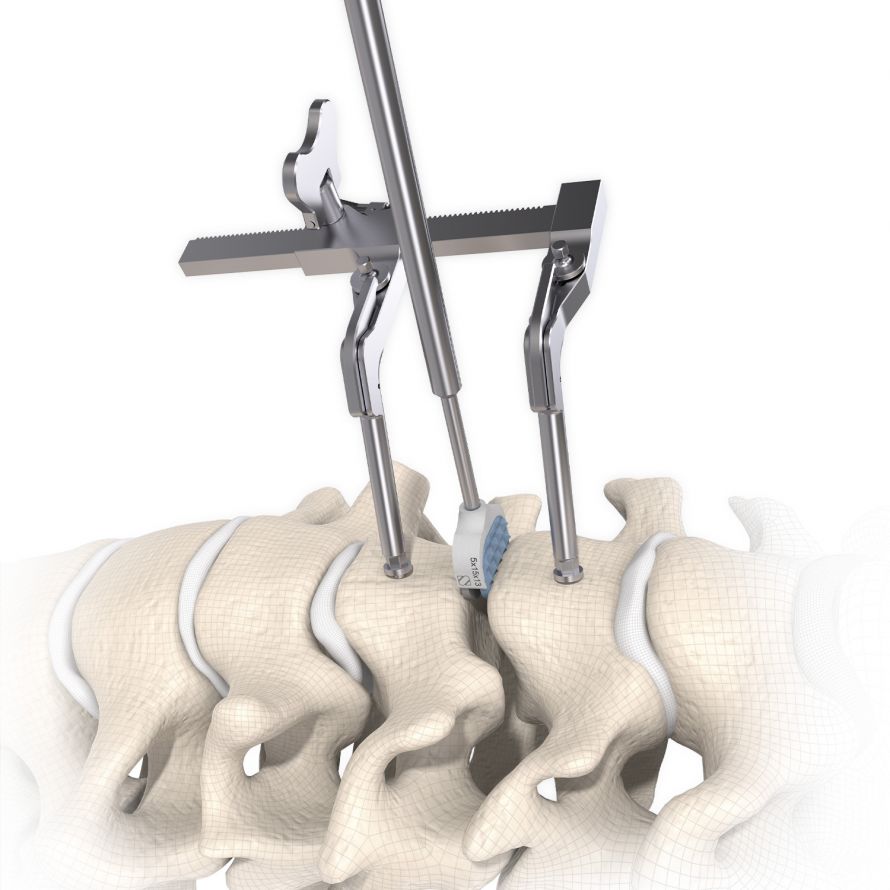 cervical, disc prosthesis, motion preservation