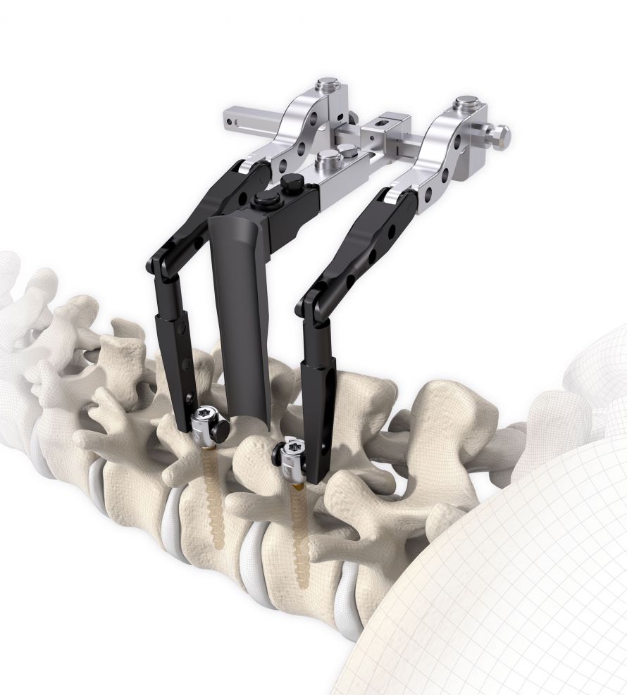 PROTEUS – Posterior lumbosacral retractor